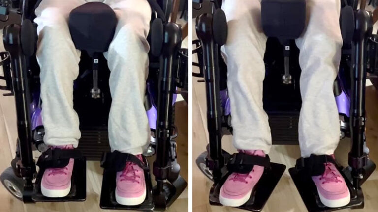 New Feature: Footplate Rotation on Dynamic Footrest | Seating Dynamics
